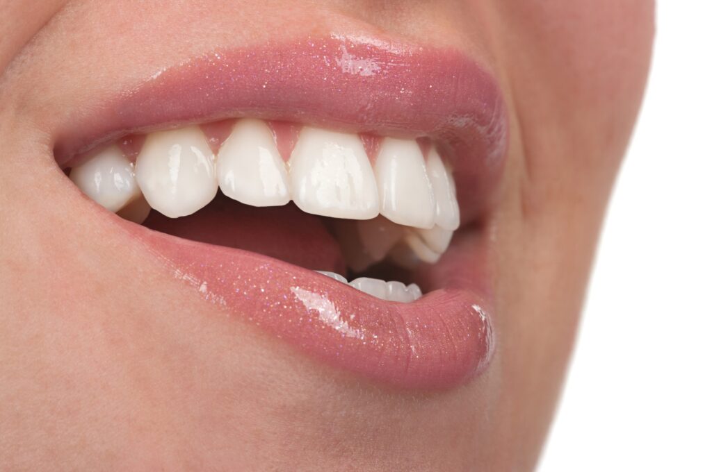 Get a Straight Smile with Instant Orthodontics